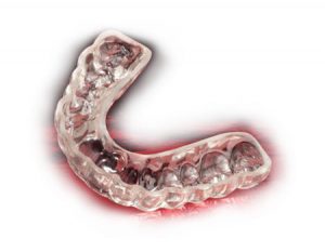 Sleep Apnea and Mouth Guards - Crane Dental Laboratory