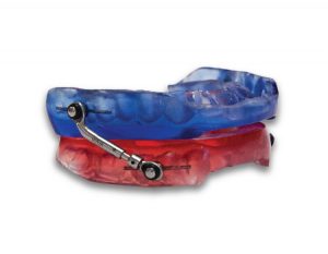 Sleep Apnea and Mouth Guards - Crane Dental Laboratory