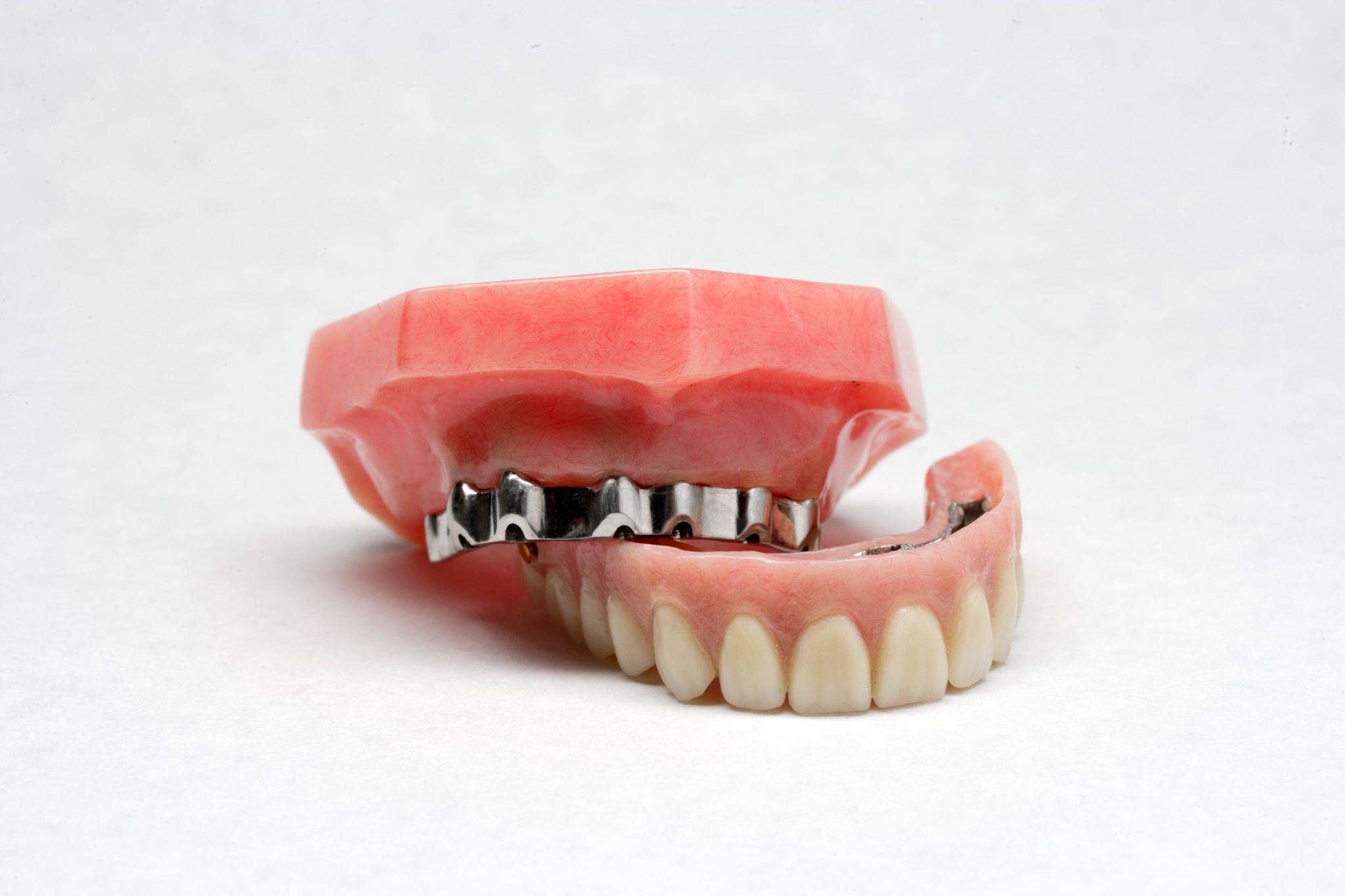 Dental Implant Prosthetics - Crane Dental